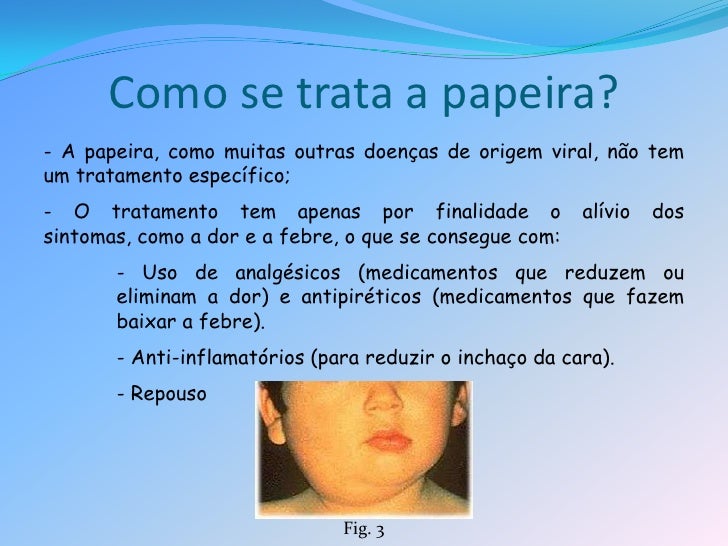 Parotidite Epidémica