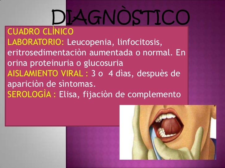 Parotiditis Que Es