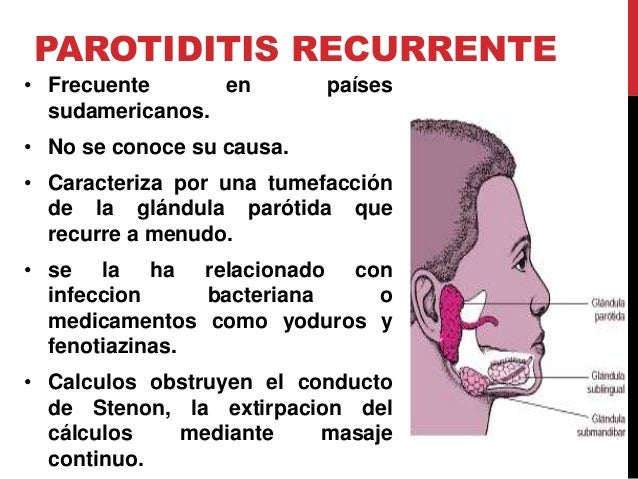 Parotiditis Que Es