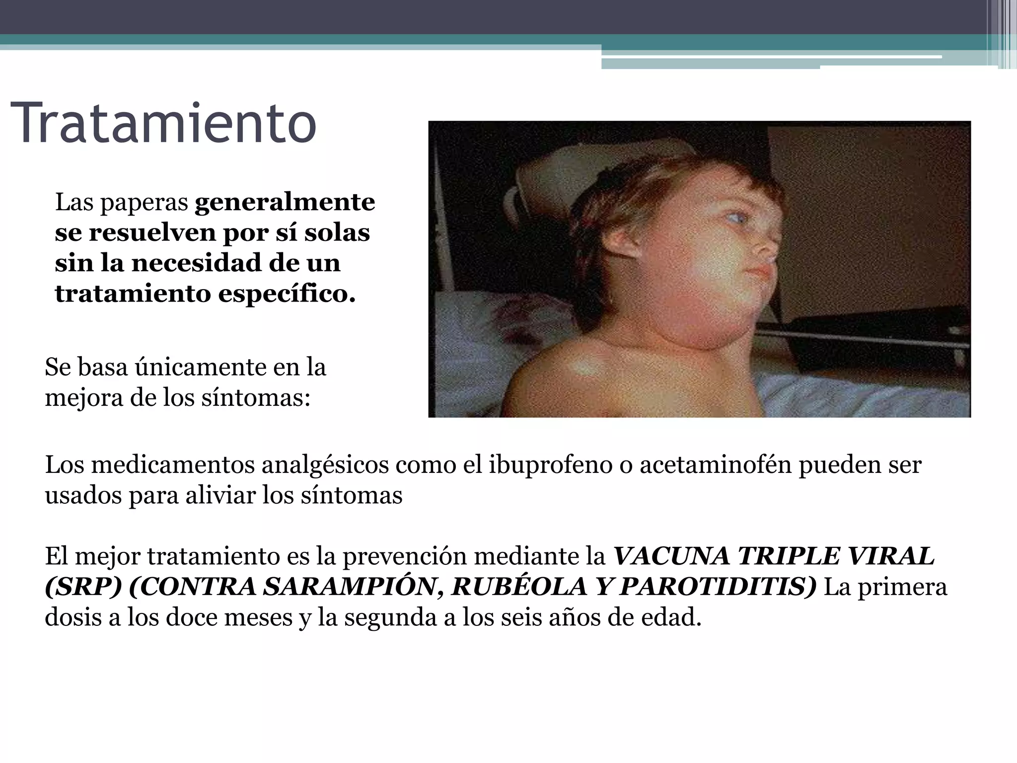 Parotiditis | PPTX