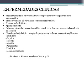 Parotiditis | PPTX