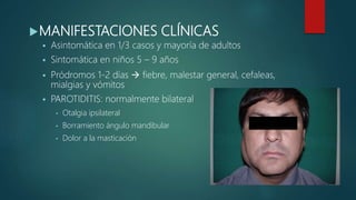 Parotiditis | PPTX