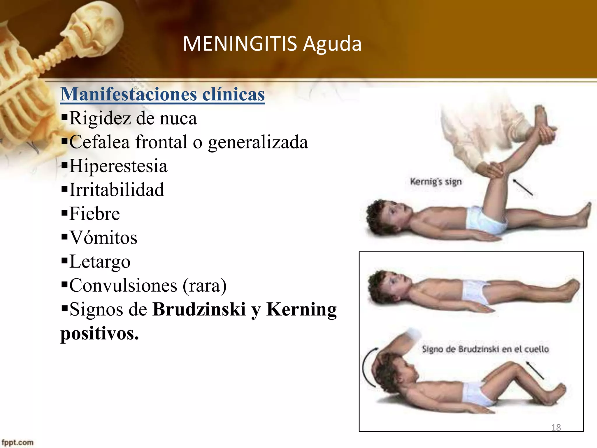 Parotiditis aguda | PPT