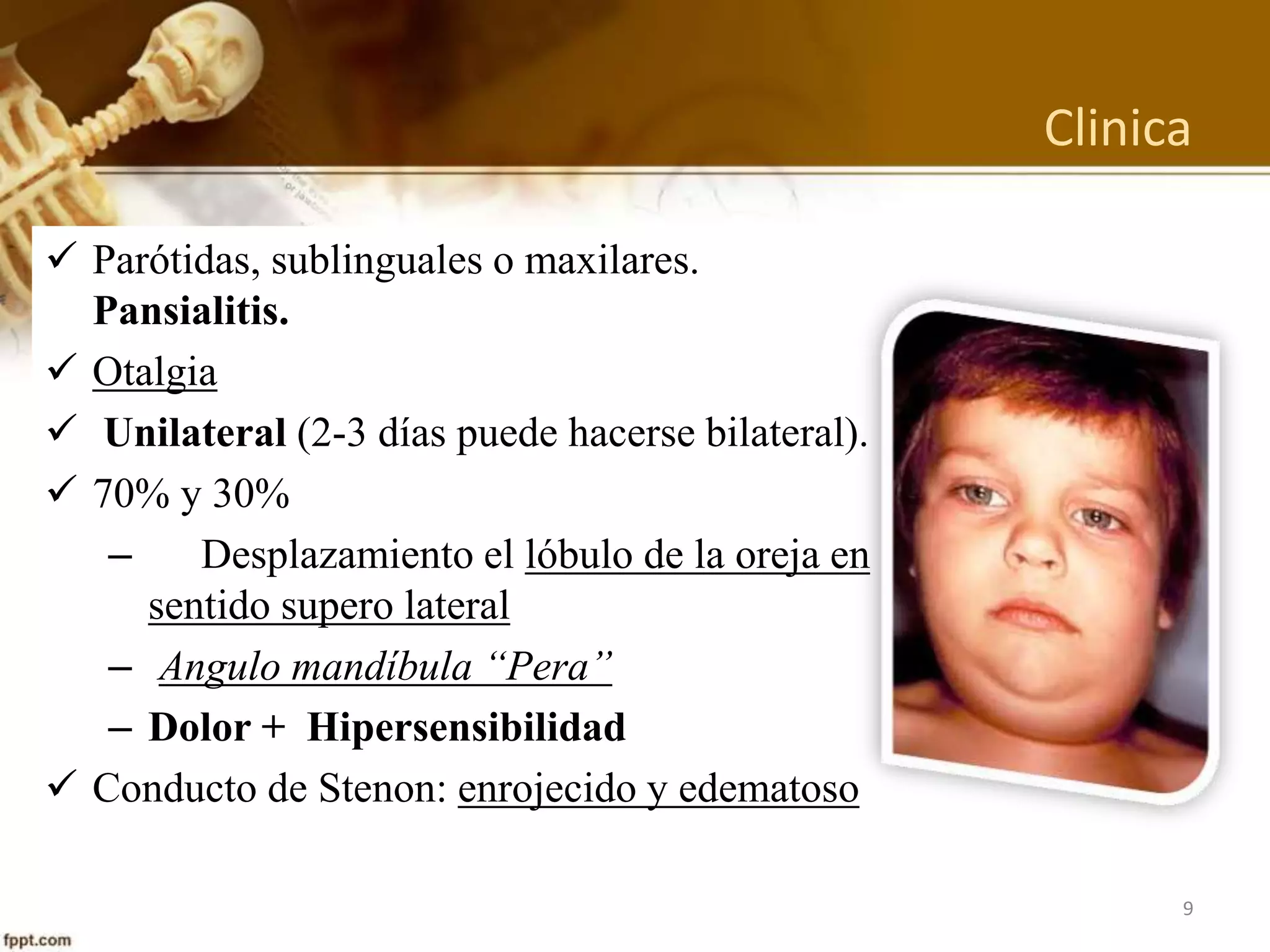 Parotiditis aguda | PPTX | Infectious Diseases | Diseases and Conditions