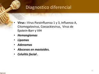 Parotiditis aguda | PPTX