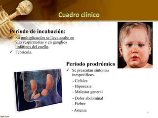 Parotiditis aguda | PPTX