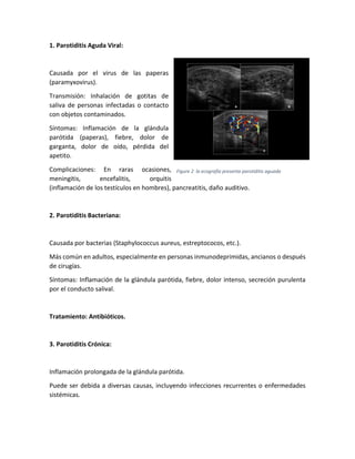 PAROTIDITIS PAPERA.pdf................................... | PDF