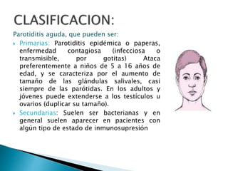 Parotiditis Taller de Salud y Ambiente. | PPTX