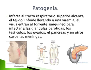 Parotiditis viral | PPTX
