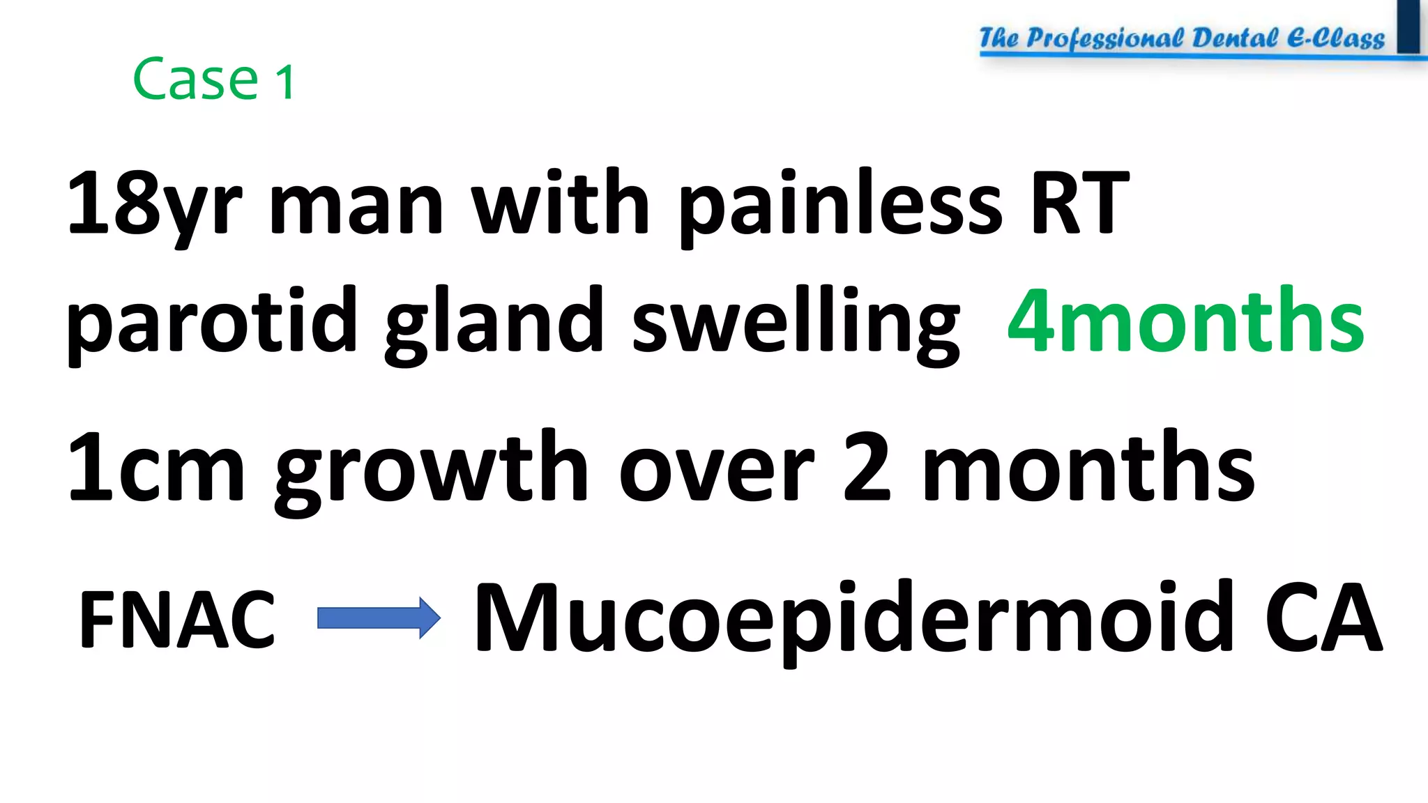 Parotid Keratocystoma | Professional Dental E-Class | PPTX | Ear, Nose ...