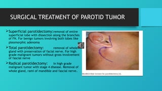 Diseases of parotid gland lecture.... (1).pptx
