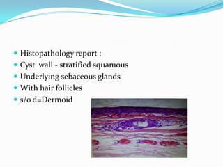 Parotid ppt | PPTX