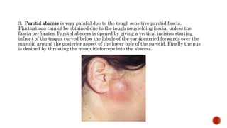 Parotid region (By: Anslin Jerbiha.E ).pptx