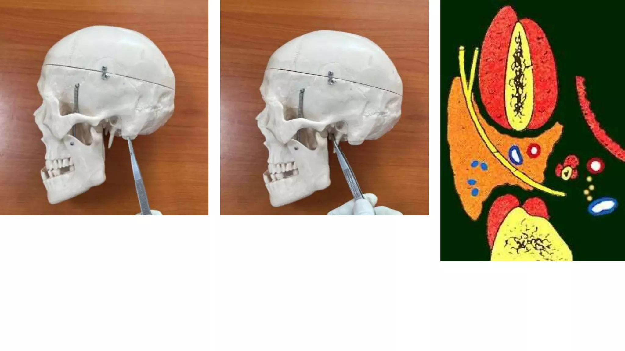 PAROTID SUBMANDIBULAR & SUBLINGUAL SALIVARY GLANDS.pptx