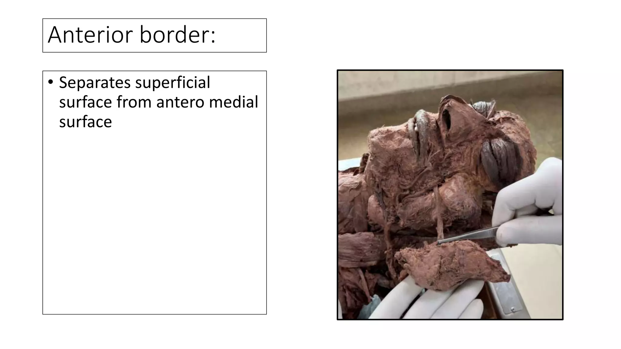 PAROTID SUBMANDIBULAR & SUBLINGUAL SALIVARY GLANDS.pptx