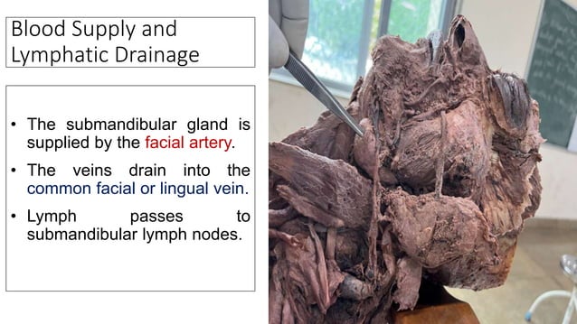 PAROTID SUBMANDIBULAR & SUBLINGUAL SALIVARY GLANDS.pptx