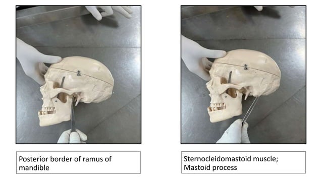 PAROTID SUBMANDIBULAR & SUBLINGUAL SALIVARY GLANDS.pptx