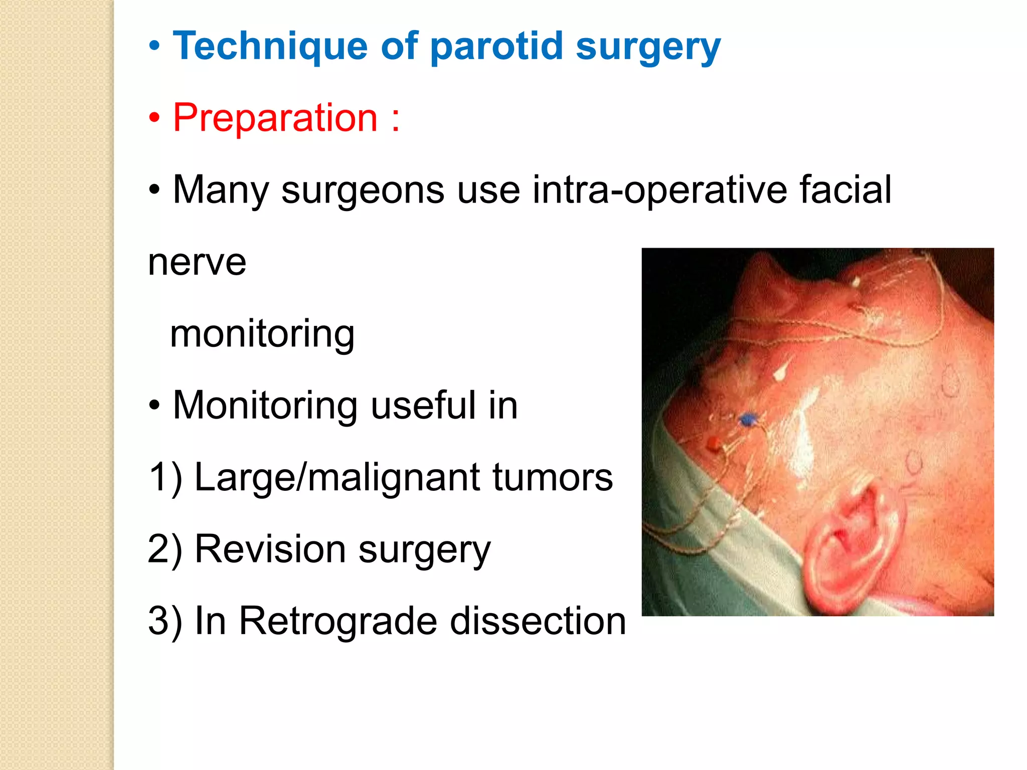 Parotid surgery | PPTX