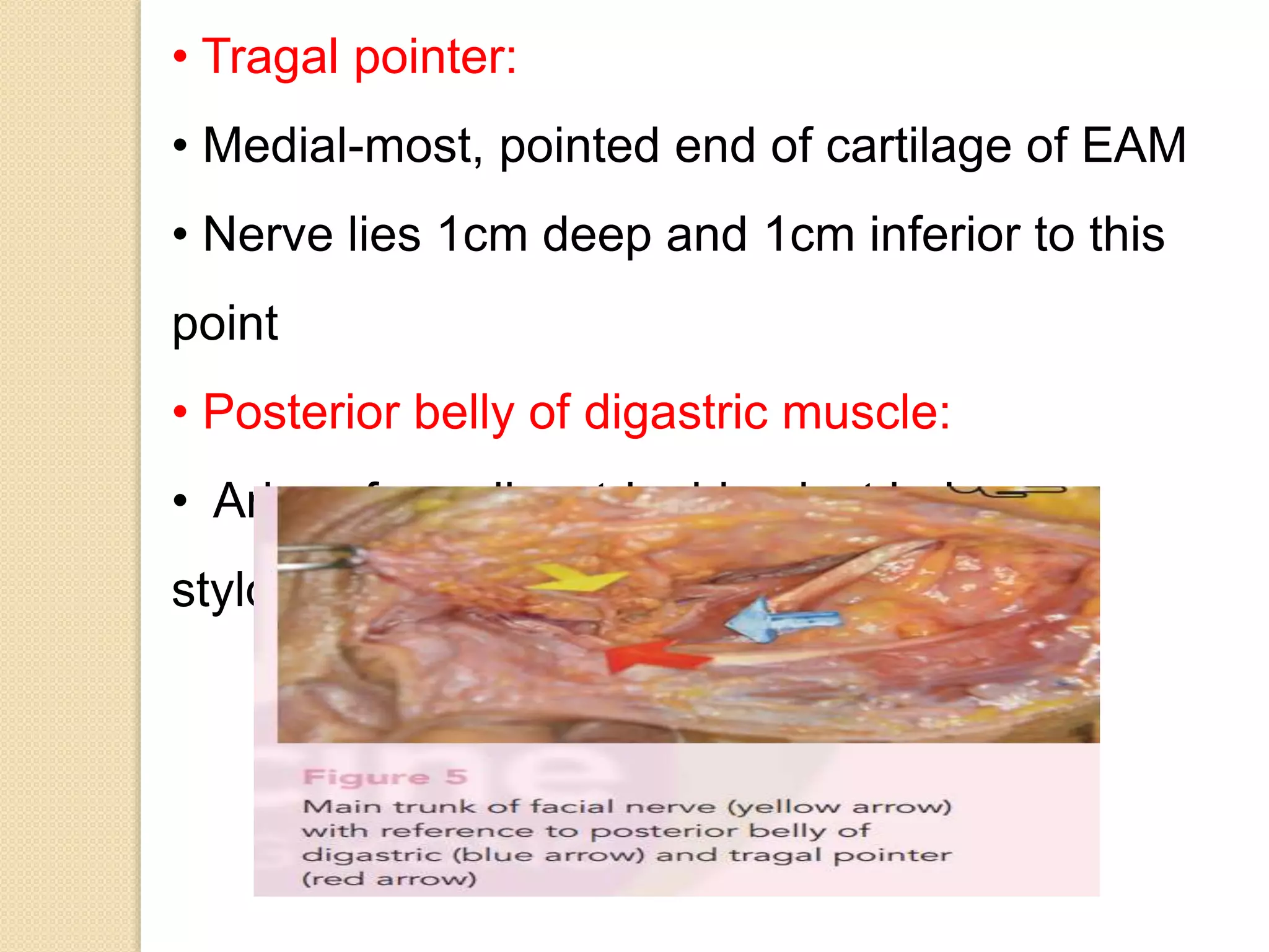 Parotid surgery | PPTX