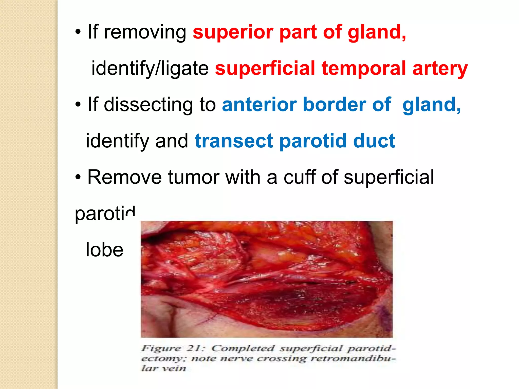 Parotid surgery | PPTX
