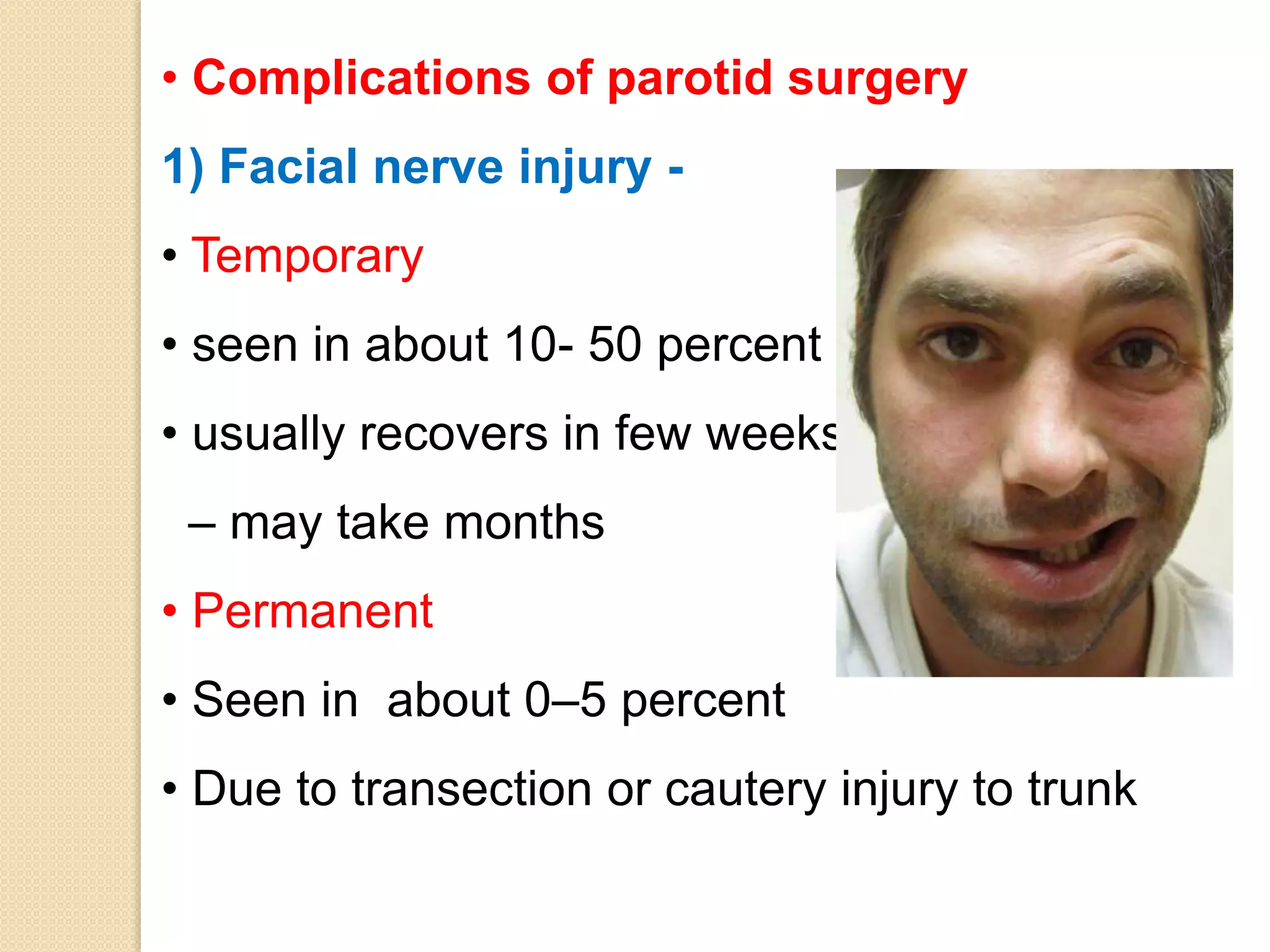 Parotid surgery | PPTX