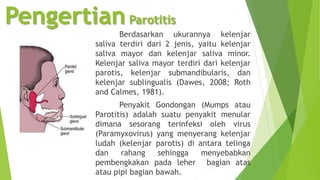 Parotitis | PPTX
