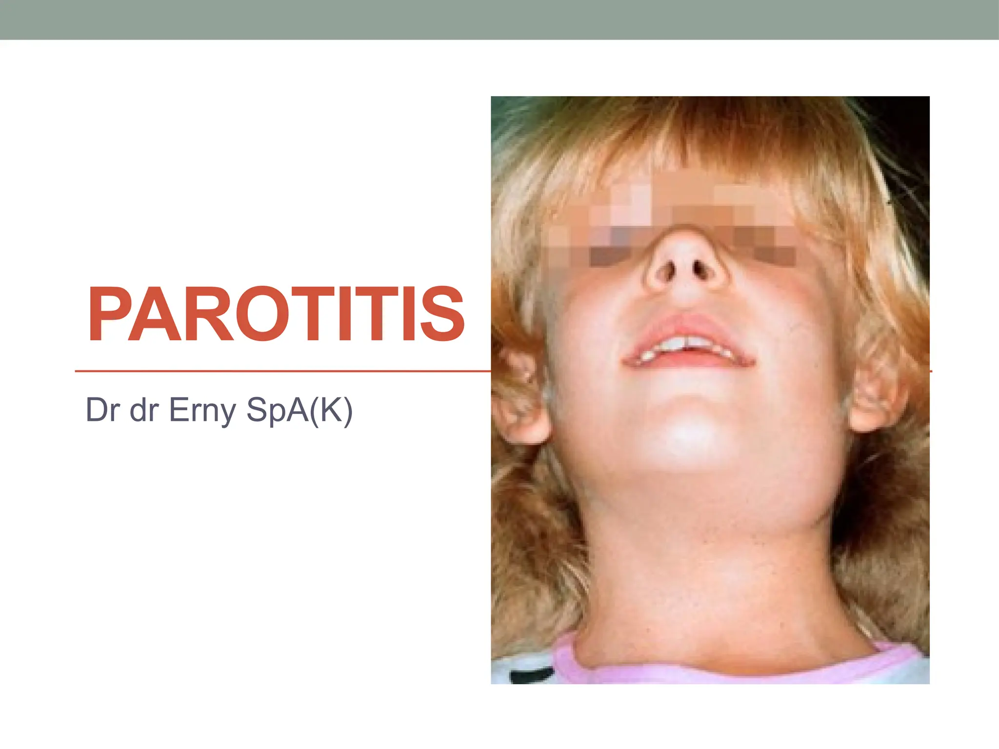 what do you mean i need minimum of 40 letter?Parotitis.pptx