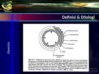 Waspada parotitis/mumps dan pencegahanya.ppt