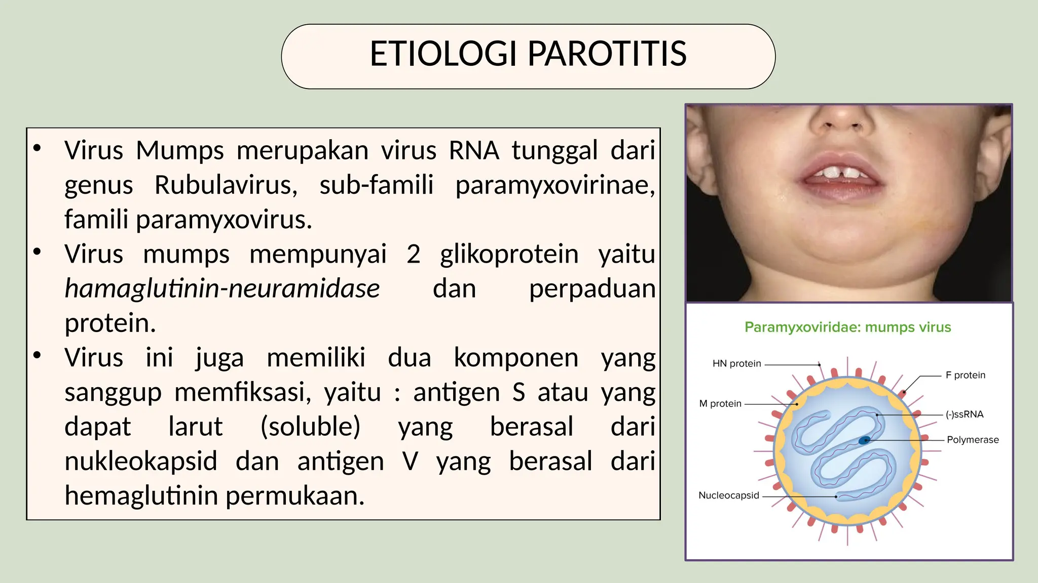 Parotitis epidemika, gondongan mumps in pediatric | PPT