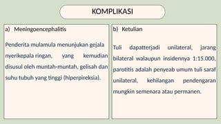 Parotitis epidemika, gondongan mumps in pediatric | PPTX