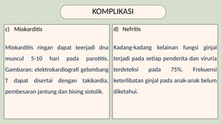 Parotitis epidemika, gondongan mumps in pediatric | PPTX