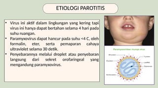 Parotitis epidemika, gondongan mumps in pediatric | PPTX