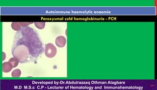 Paroxysmal Cold Hemoglobinuria