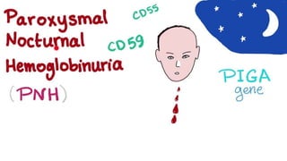 Paroxysmal nocternal hemoglobinuria | PPTX
