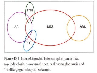 Paroxysmal A Cell In Diagram