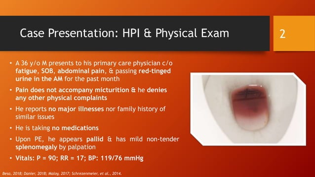 Paroxysmal Nocturnal Hemoglobinuria (PNH) - A Pathologic Survey | PPTX ...