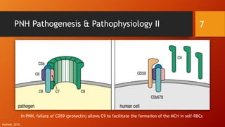 Paroxysmal Nocturnal Hemoglobinuria (PNH) - A Pathologic Survey | PPTX