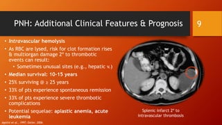 Paroxysmal Nocturnal Hemoglobinuria (PNH) - A Pathologic Survey | PPTX
