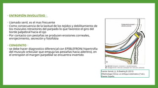 materia de oftalmologia: tema Parpados y sus patologias | PPTX