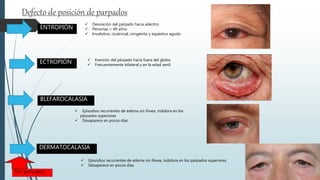 Parpado y patologias | PPTX
