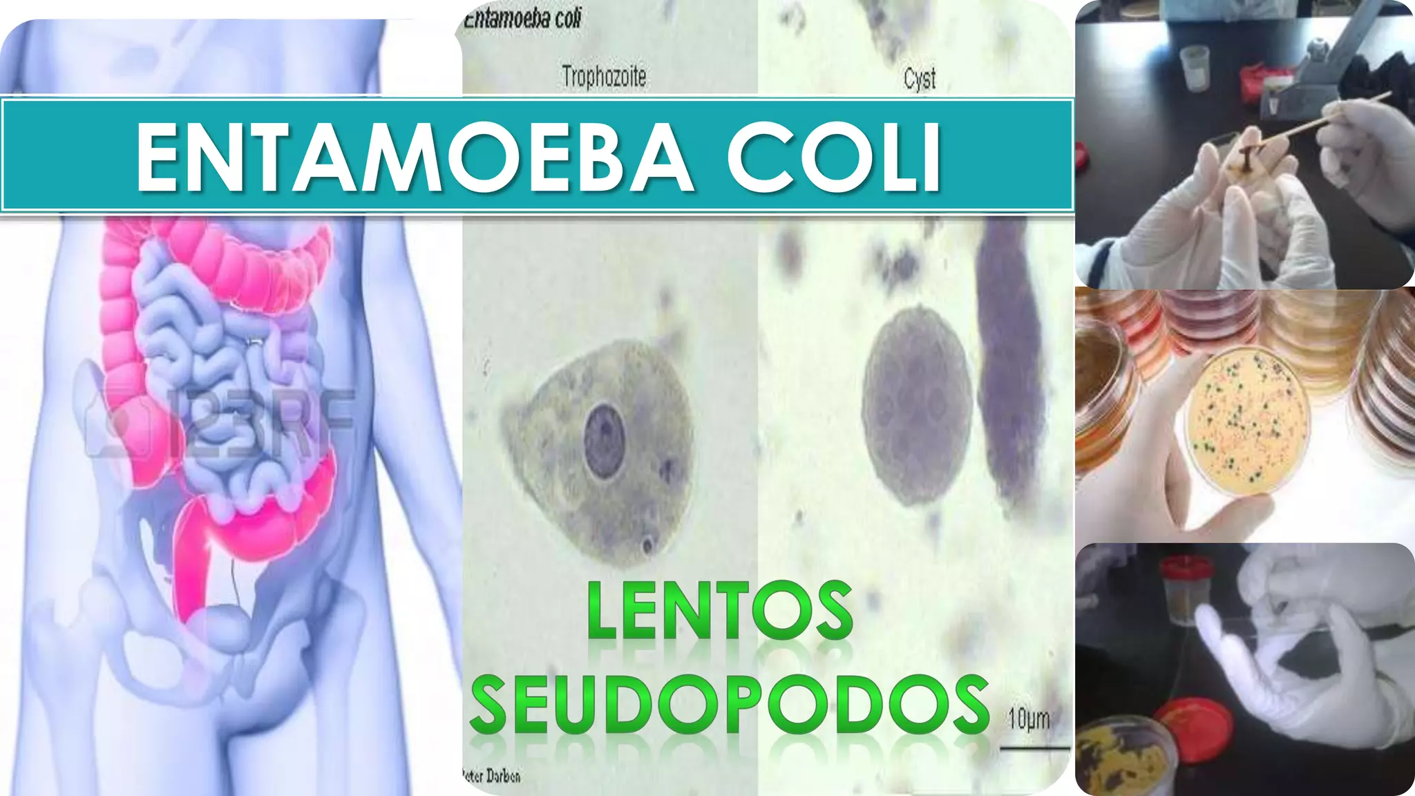 Entamoeba histolytica | PPTX