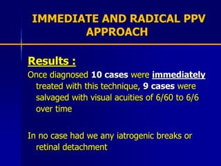 EMERGENCY PARS PLANA VITRECTOMY FOR ACUTE POST - CATARACT ...