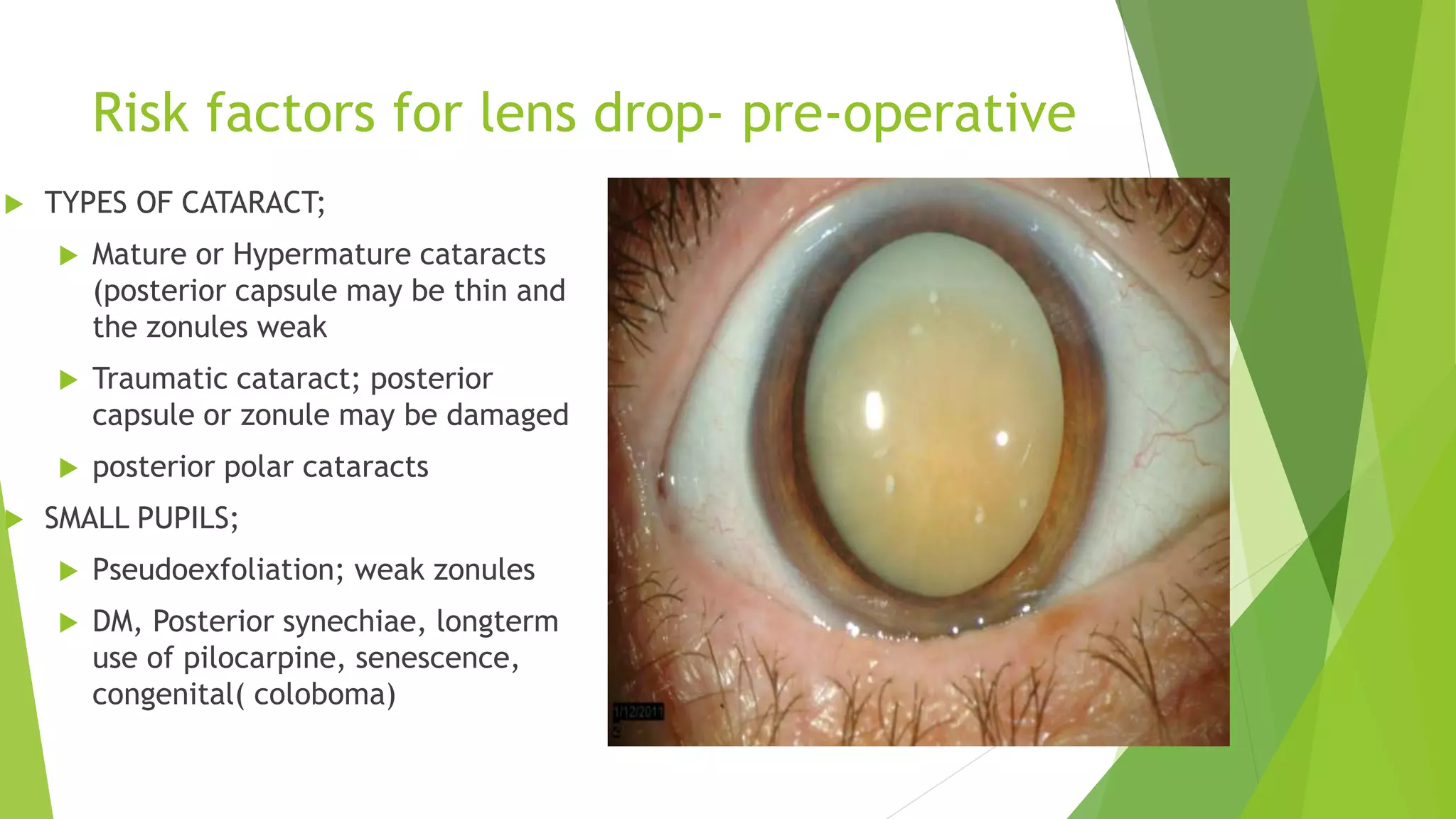 PARS PLANA VITRECTOMY FOR LENS DROP.pptx