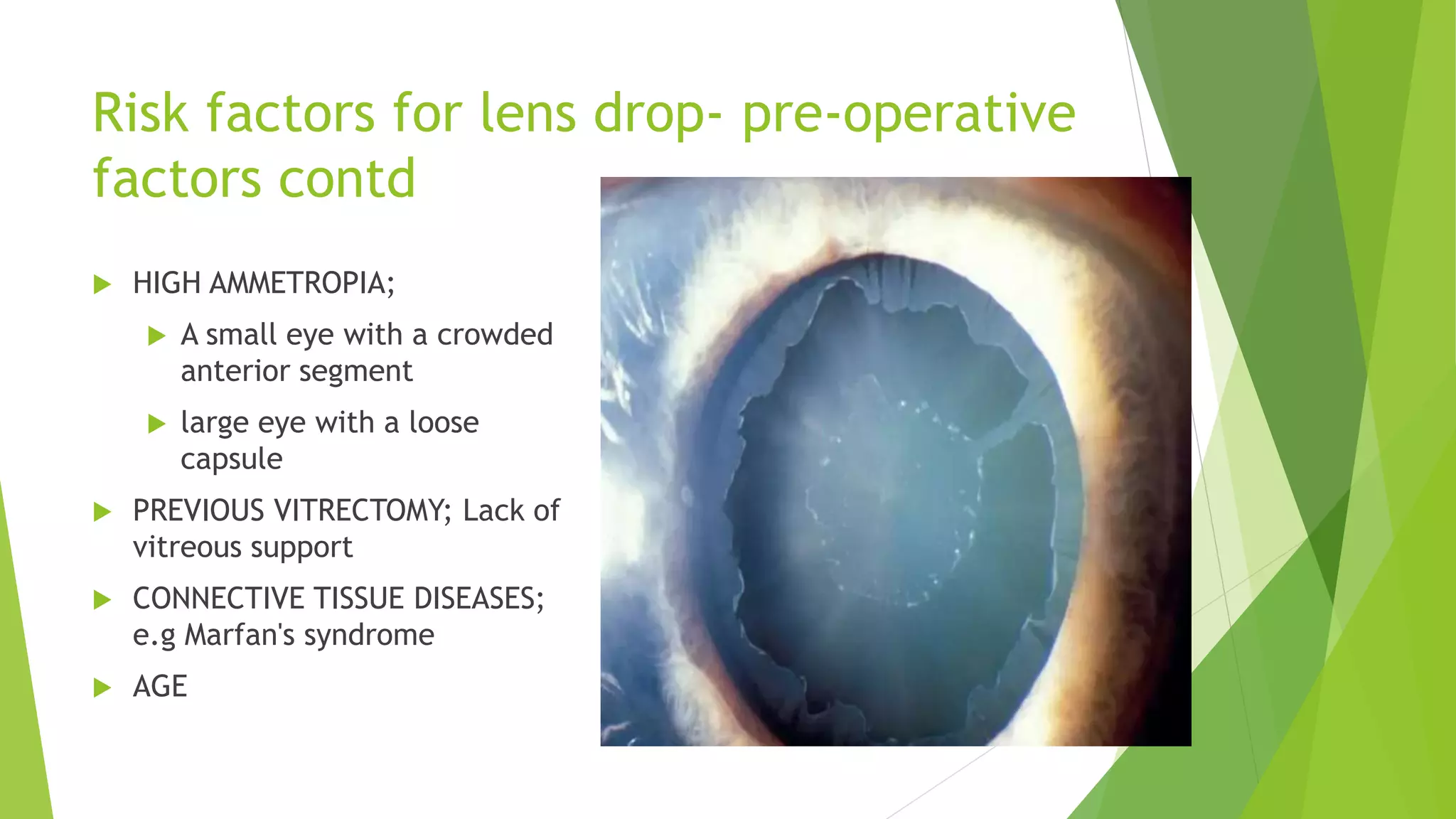 PARS PLANA VITRECTOMY FOR LENS DROP.pptx