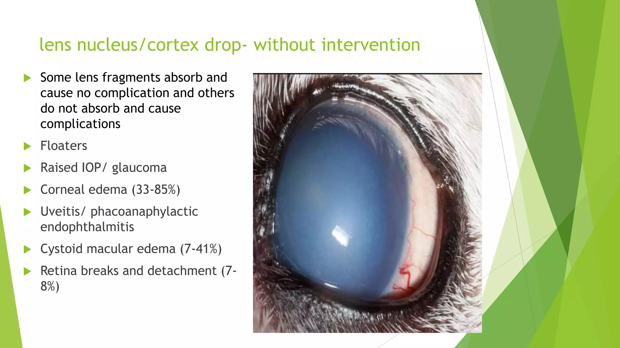 PARS PLANA VITRECTOMY FOR LENS DROP.pptx