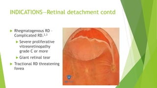 PARS PLANA VITRECTOMY FOR LENS DROP.pptx