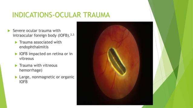 PARS PLANA VITRECTOMY FOR LENS DROP.pptx | Eye and Vision Conditions ...