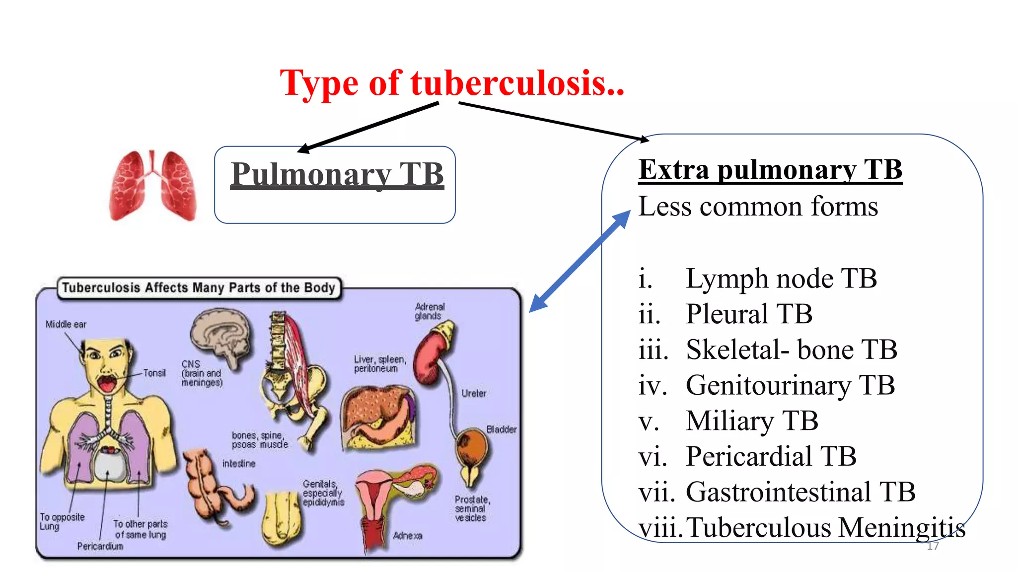 Part- 1. Pathophysiology of TB and 1st and 2nd line AKT, DR. Kiran G ...