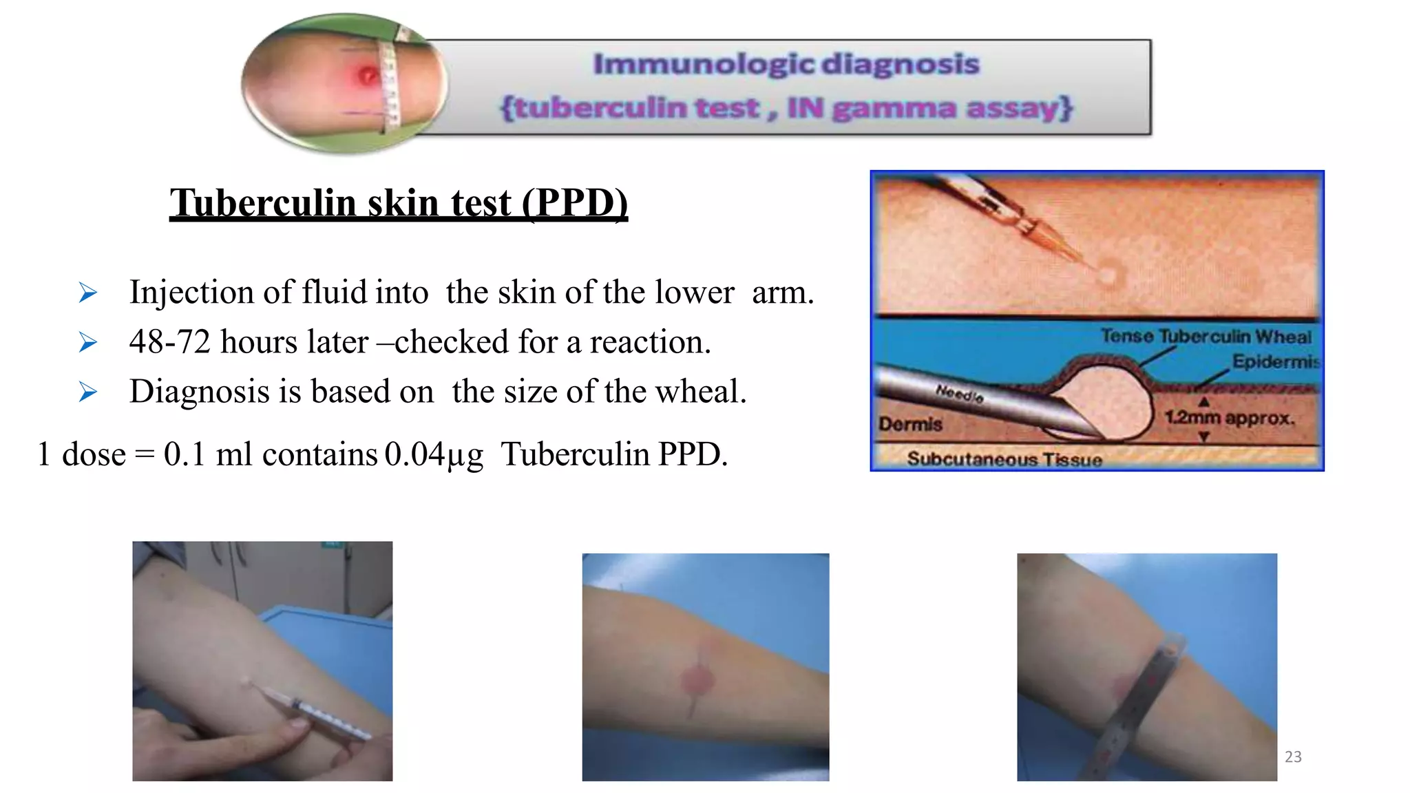 Part- 1. Pathophysiology of TB and 1st and 2nd line AKT, DR. Kiran G ...