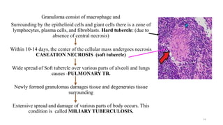 Part- 1. Pathophysiology of TB and 1st and 2nd line AKT, DR. Kiran G ...